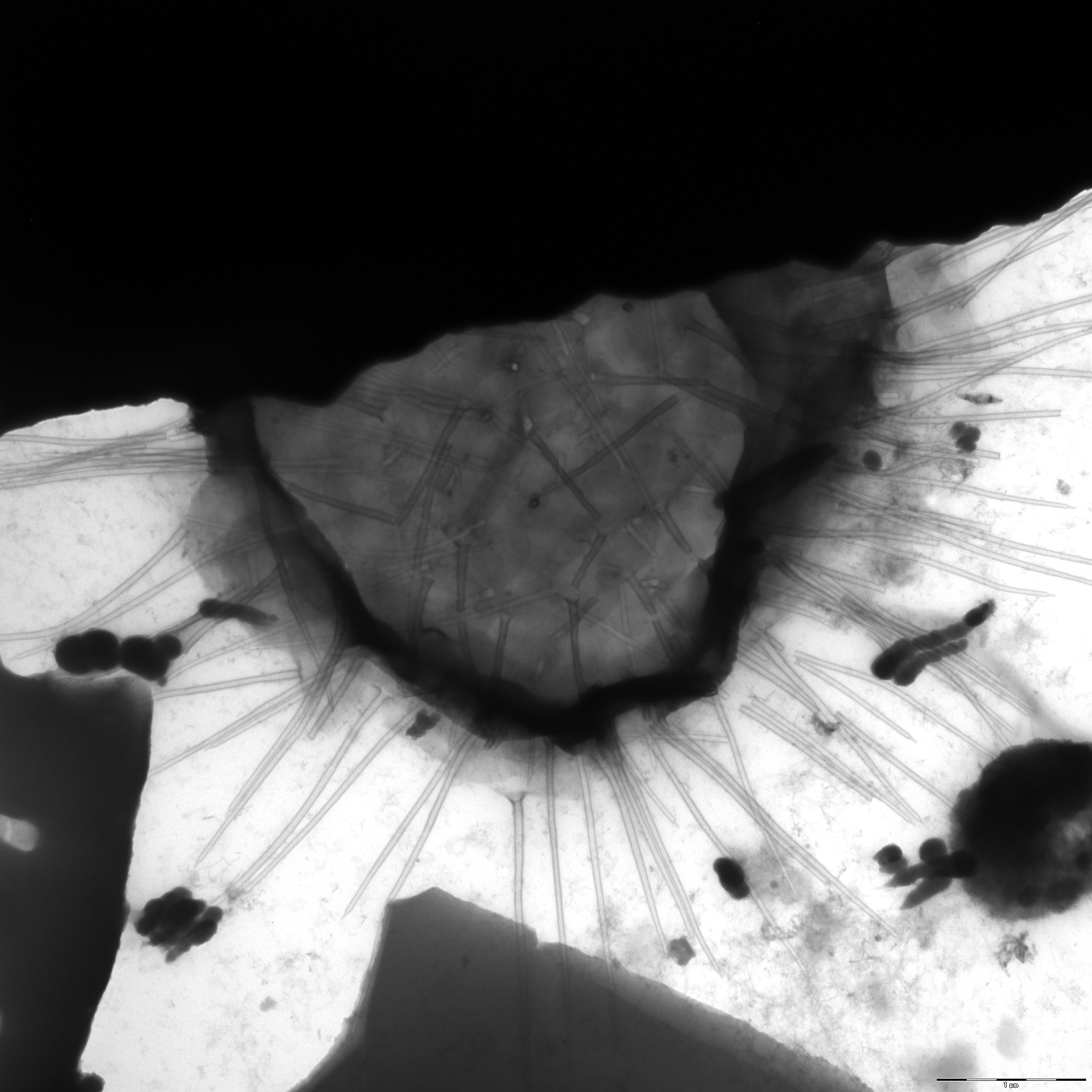 Paraphysomonas imperforata | Silica-scaled chrysophytes of Europe