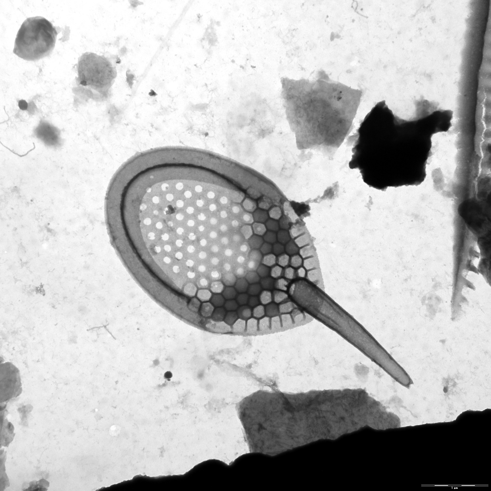 Synura spinosa | Silica-scaled chrysophytes of Europe