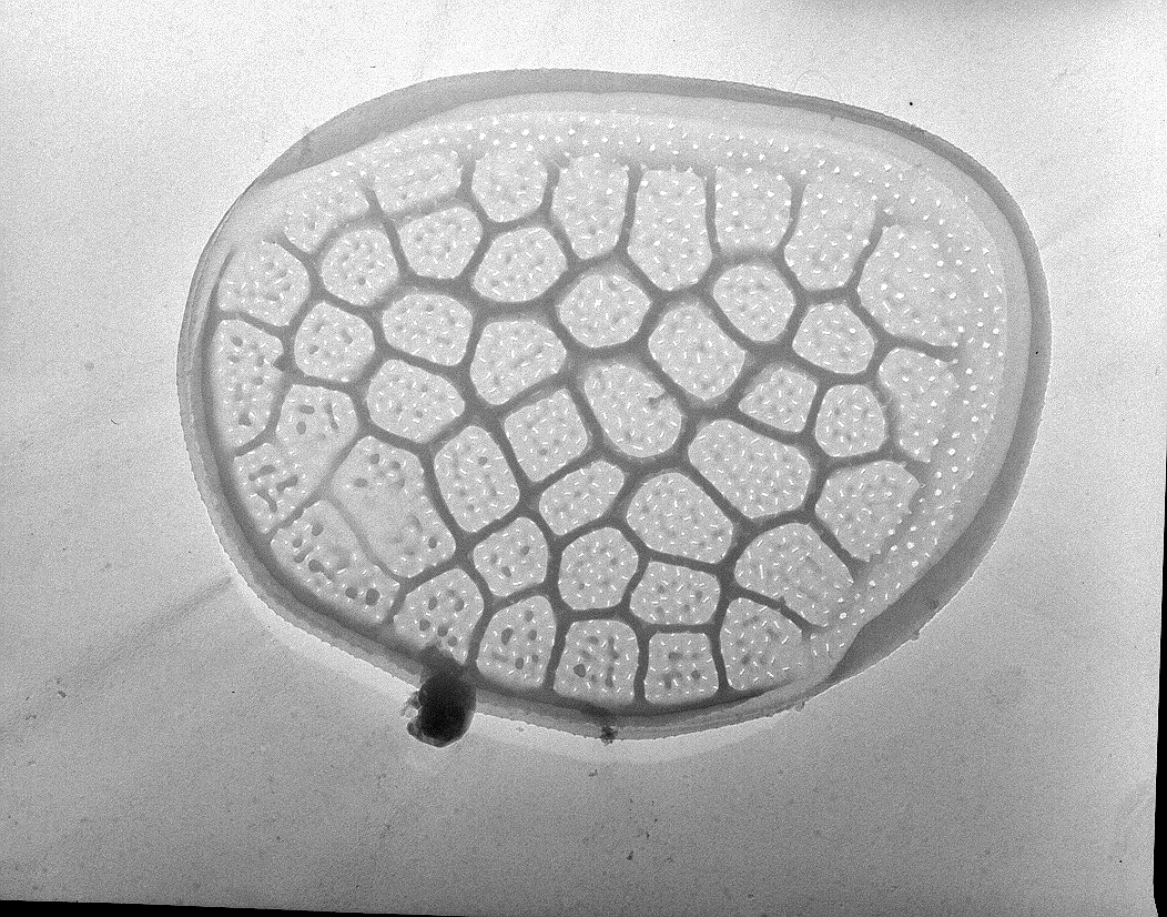 Mallomonas teilingii | Silica-scaled chrysophytes of Europe