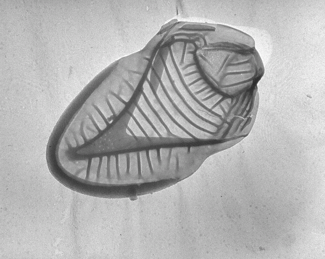 Mallomonas corcontica | Silica-scaled chrysophytes of Europe